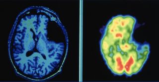 Making Reason of Insanity | Psychology Today