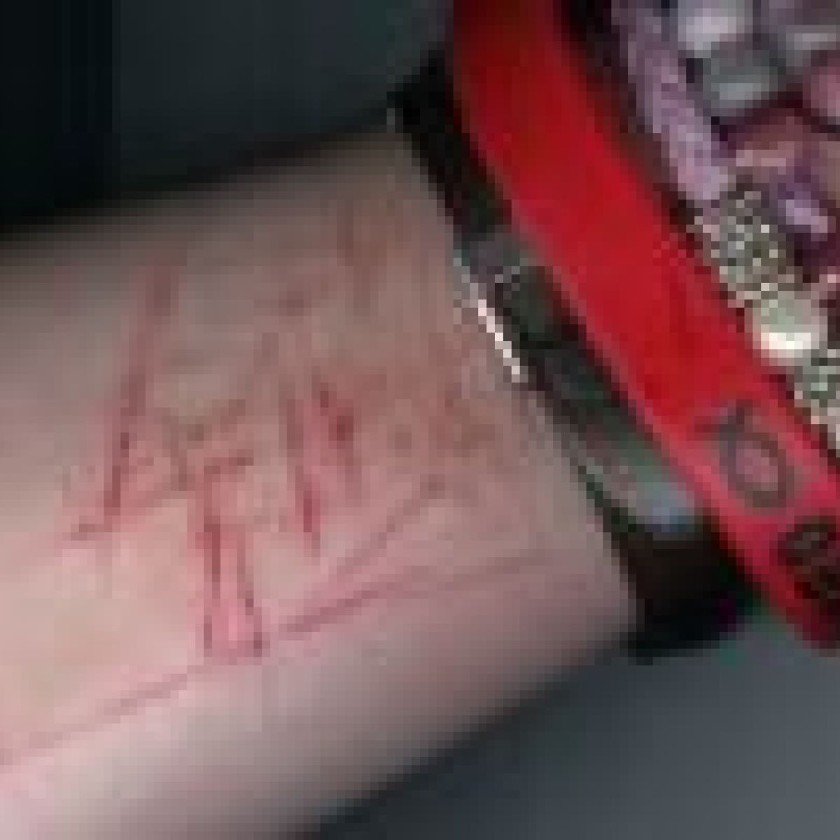 self harm cuts infected