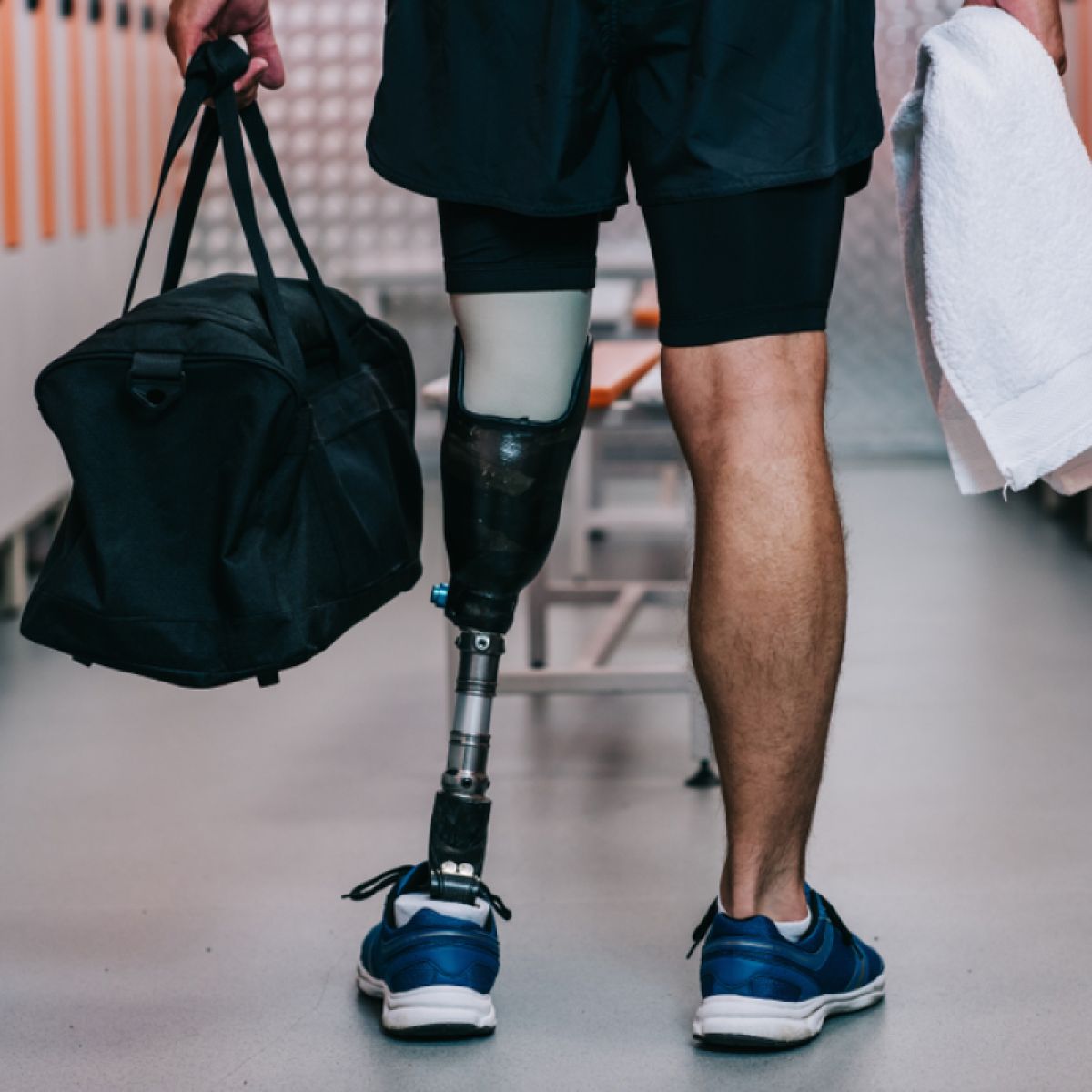 prosthetics sheffield