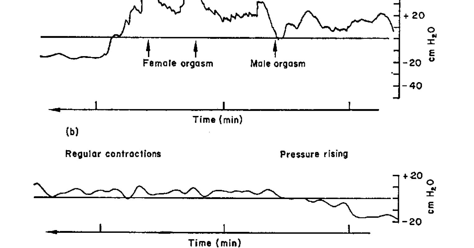 Mind The Gap | Psychology Today