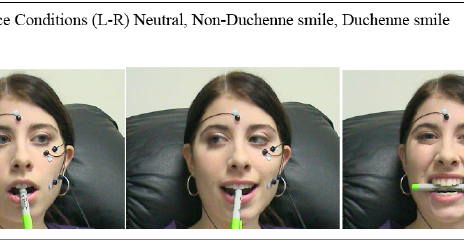Duchenne Smile