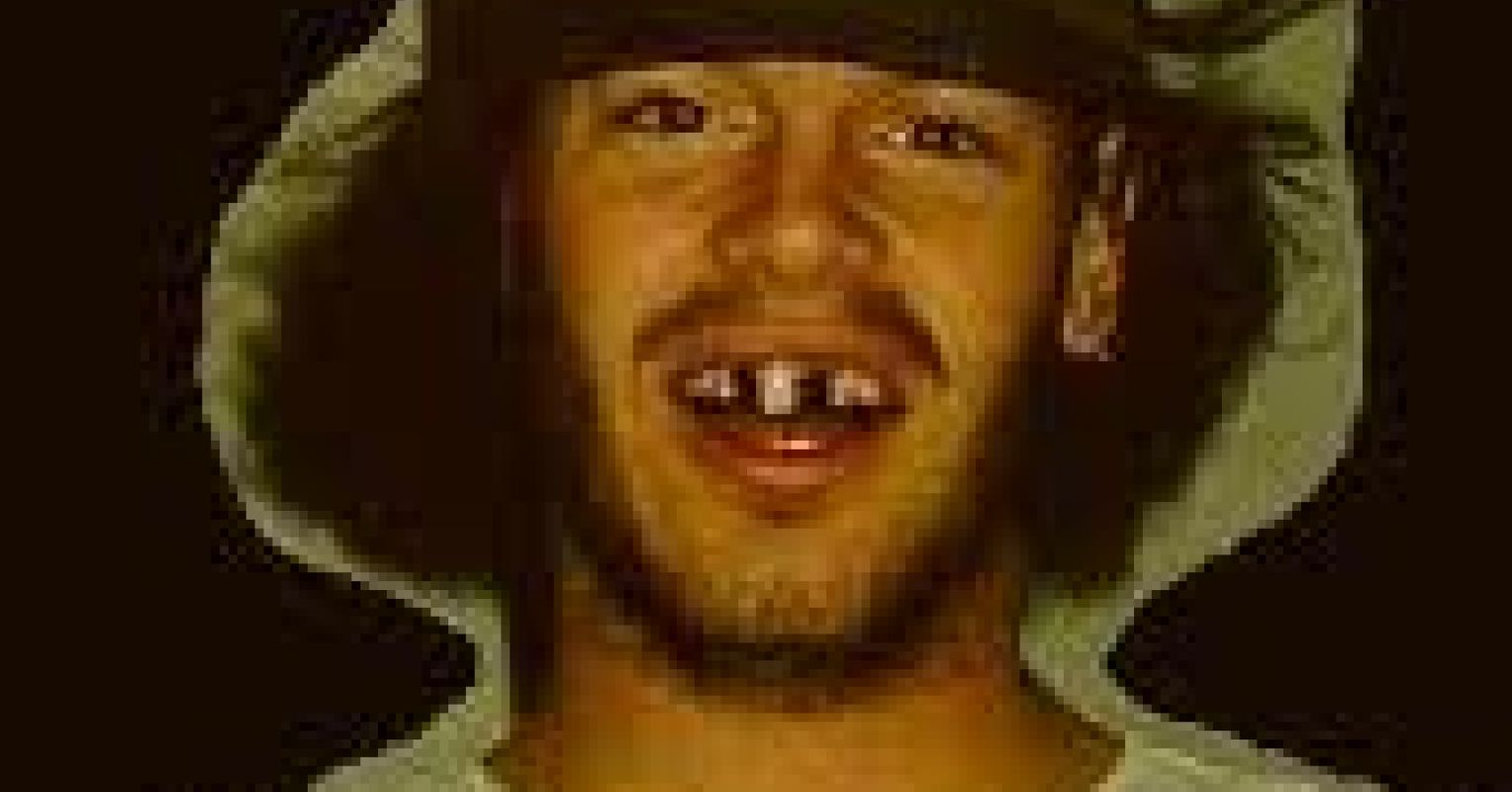 Losing Your Teeth, and Your Mind? | Psychology Today