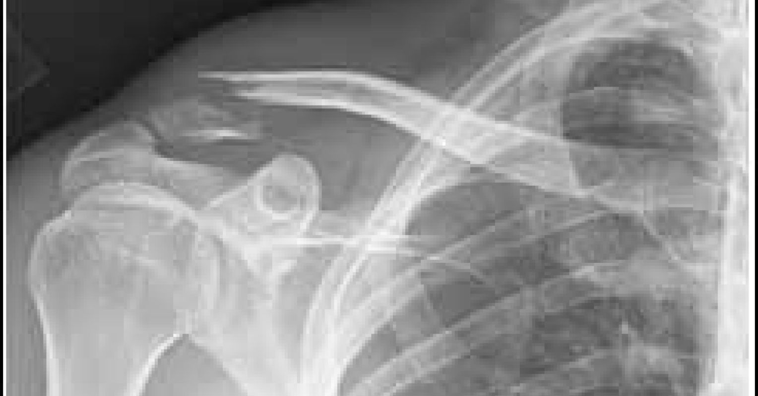 How To Heal Injuries | Psychology Today