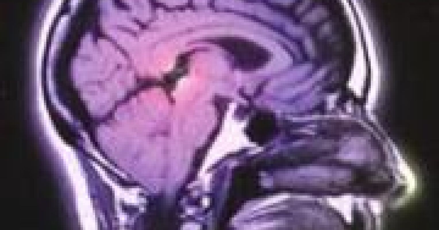 All about Brain Scans | Psychology Today