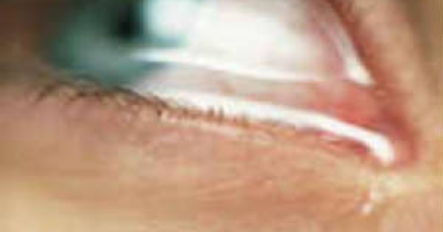 The Identifiable Victim Effect in Action | Psychology Today