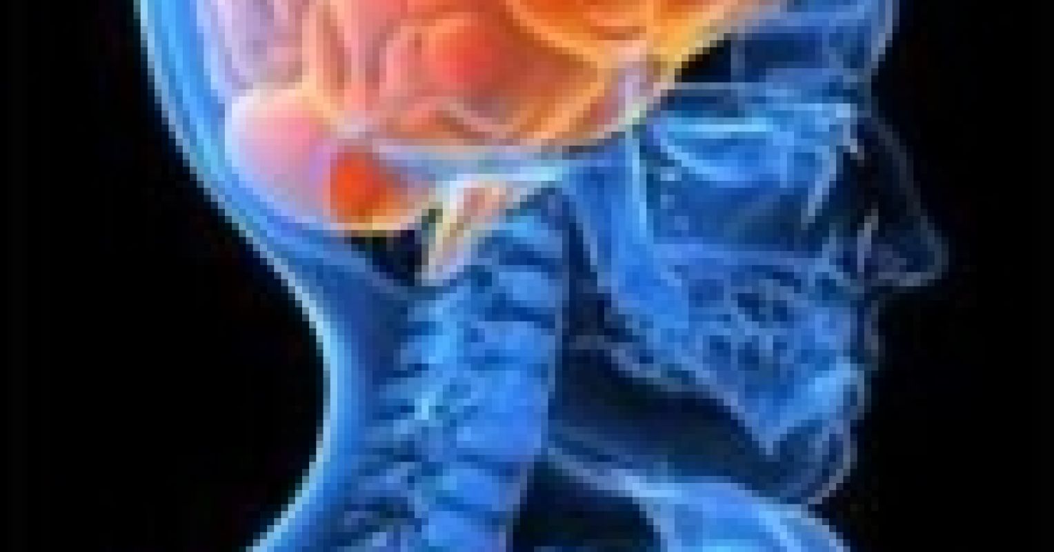 Memory, the Amygdala, and PTSD. | Psychology Today Australia