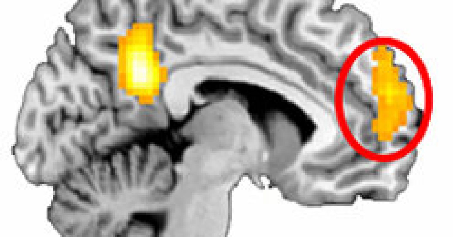 Hyper-mentalism: not just philosophy, visible in the brain ...