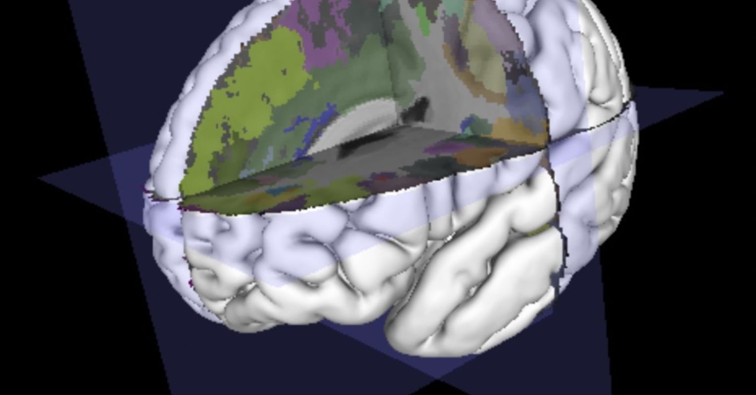 New Brain Maps Advance Understanding, With Limitations | Psychology Today