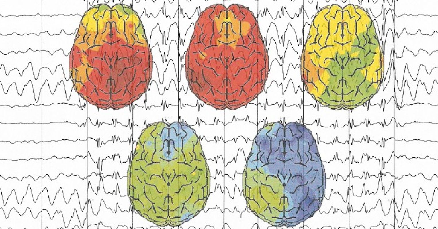 Surfing Brainwaves With EEG | Psychology Today United Kingdom