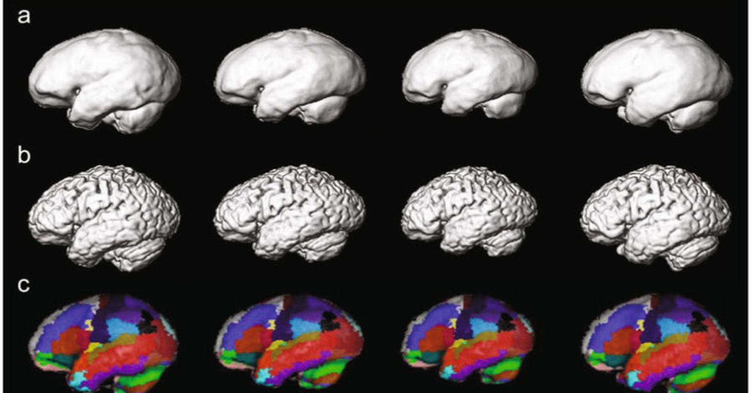 Bigger Cerebellum Size May Have Helped Early Humans Thrive | Psychology ...