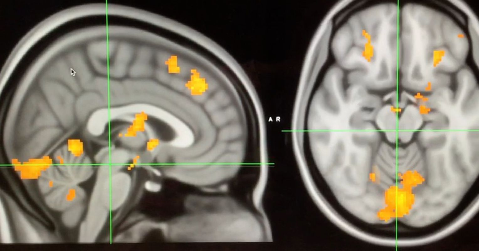 Empathic People Use Social Brain Circuitry to Process Music ...