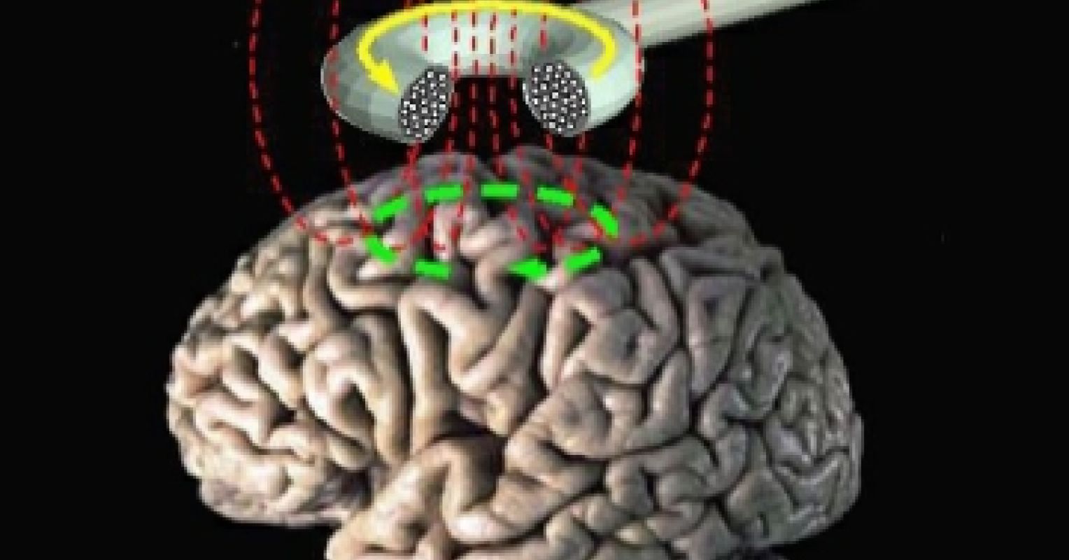 Brain Stimulation Could be the Depression Treatment We Need ...