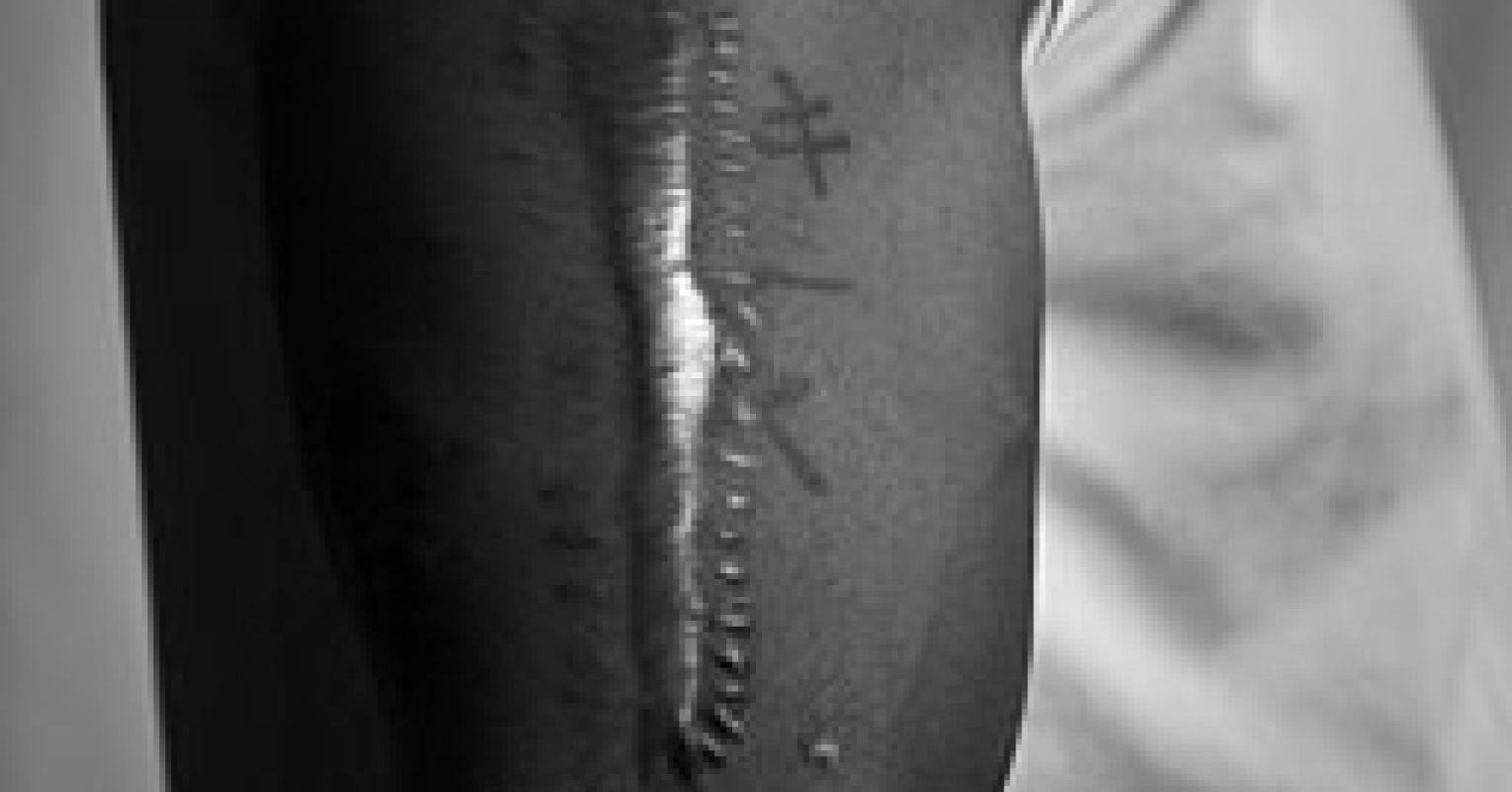 The Real Story of PTSD | Psychology Today Canada