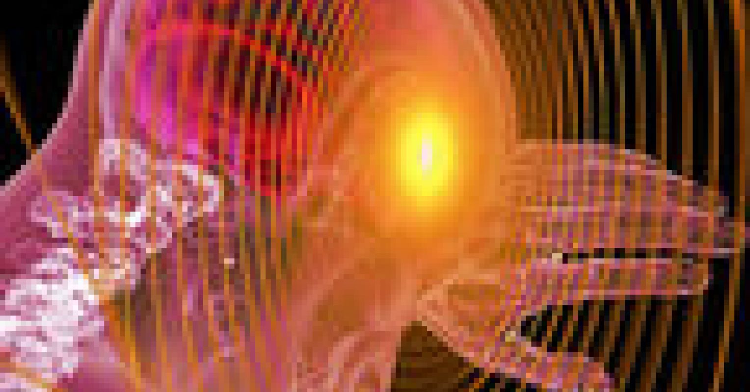 Stanford Unveils AI Tool for Finding Brain Aneurysms | Psychology Today