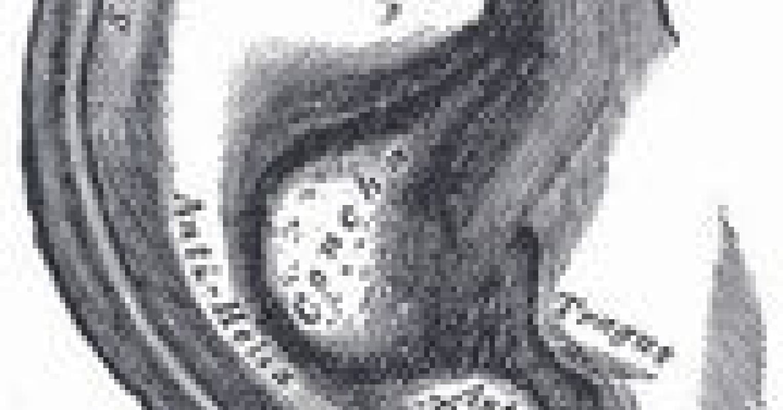 Vagus Nerve Stimulation via the Outer Ear Takes Center Stage ...