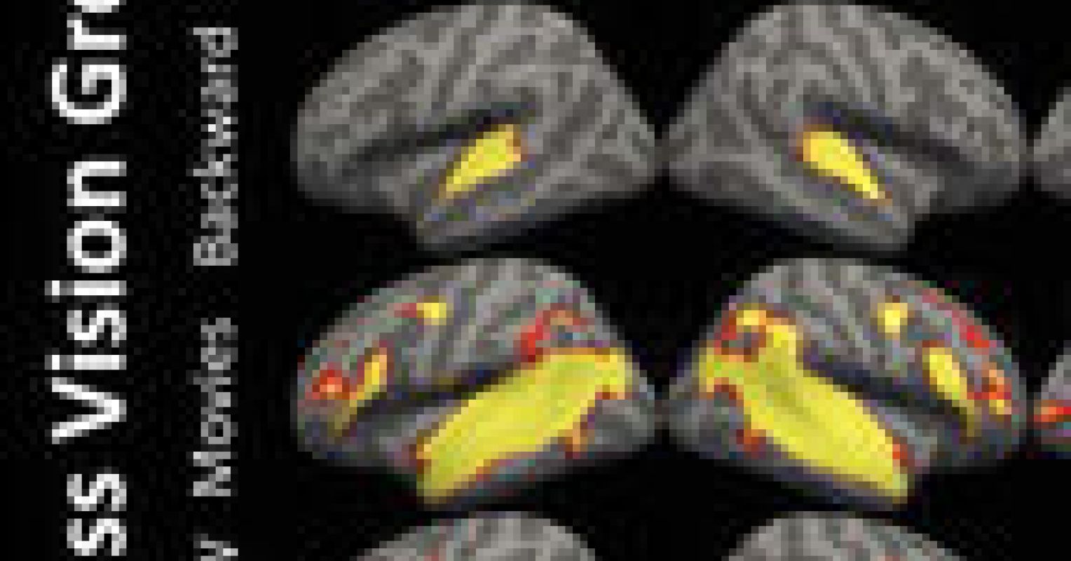 Unused Brain Regions Can Be Repurposed via Neuroplasticity | Psychology ...