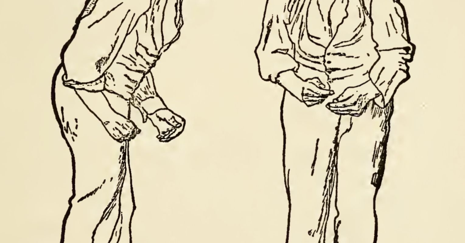 Does Impaired Movement Impair Thinking About Movement? | Psychology Today