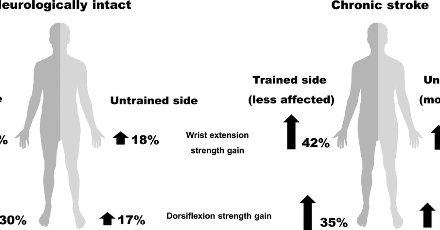 Strength After Stroke Begins in the Brain | Psychology Today