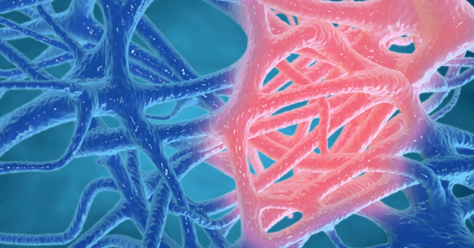 The Relationship Between Inflammation and Depression | Psychology Today