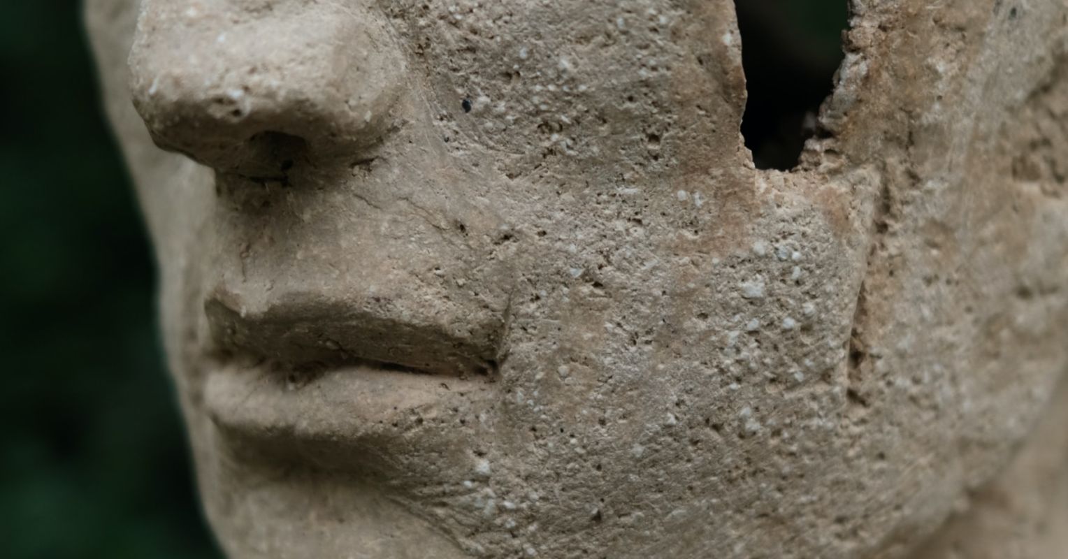 Why Are People Biased Against Anomalous Facial Features? | Psychology Today