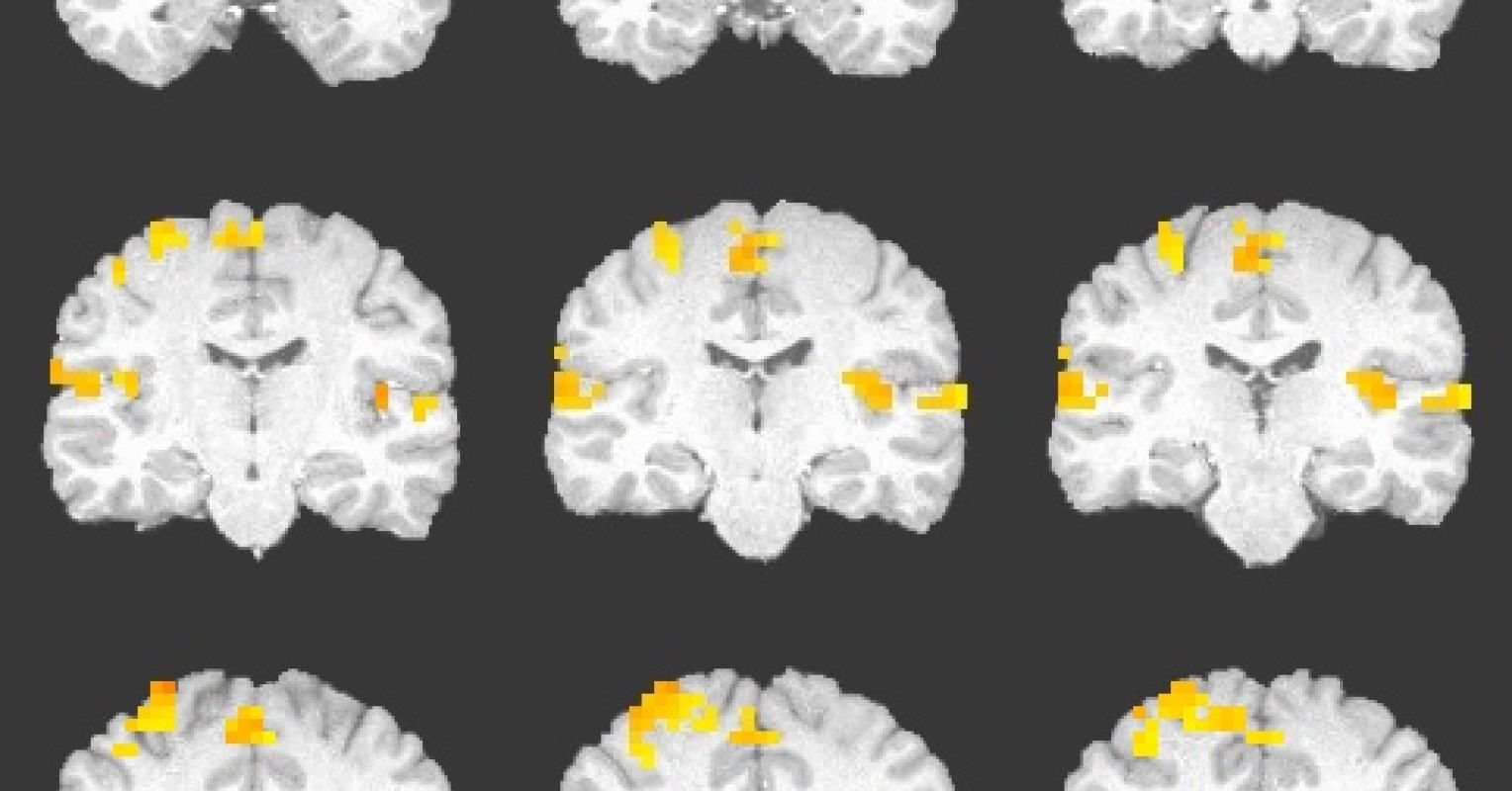 The Mystery of Subjective Time: A Case for Embodiment | Psychology ...