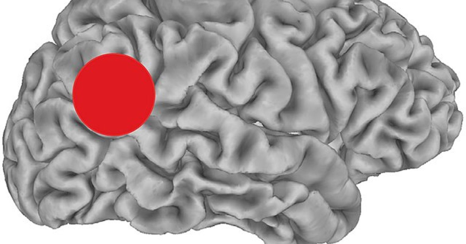 Temporoparietal Vs Temporal