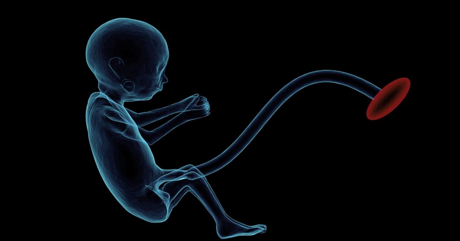 Rare Birth Defects In Babies