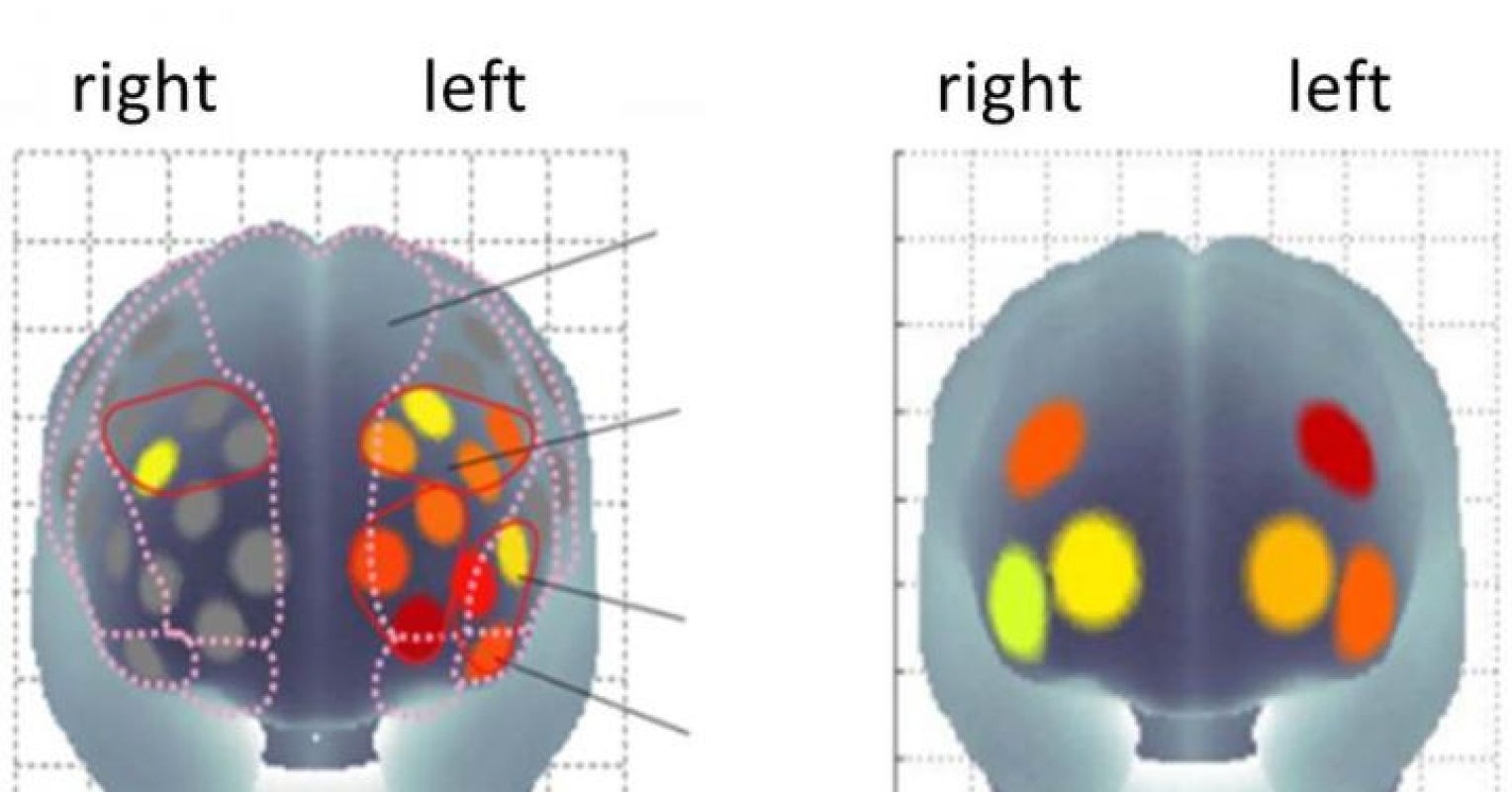Physical Activity Is the No. 1 Way to Keep Your Brain Young ...
