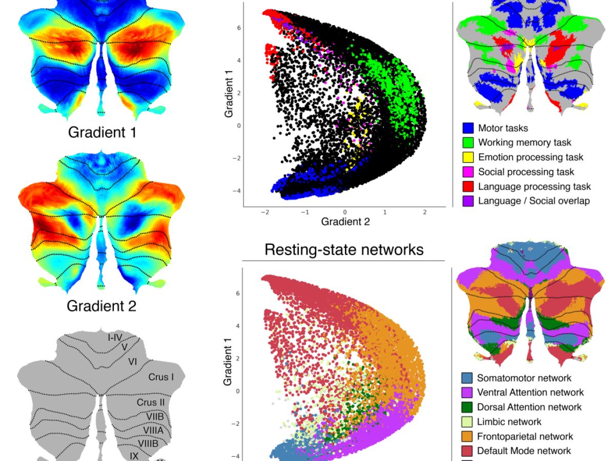 right cerebellar hemisphere function