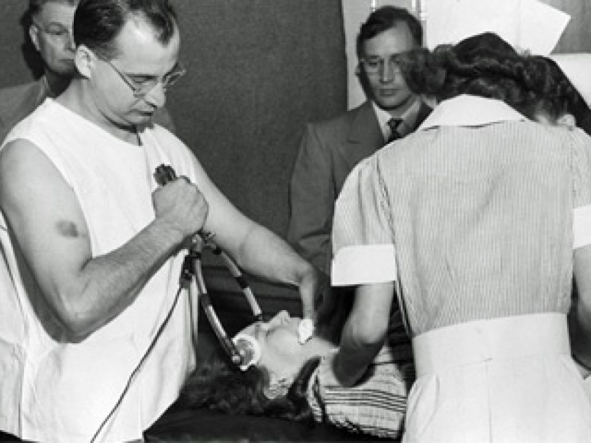 electroconvulsive shock therapy side effects