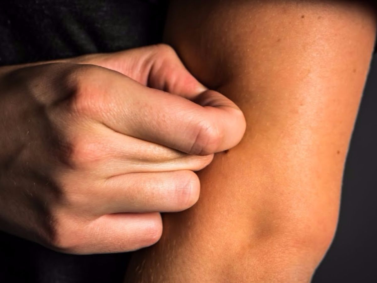 repeated scab picking