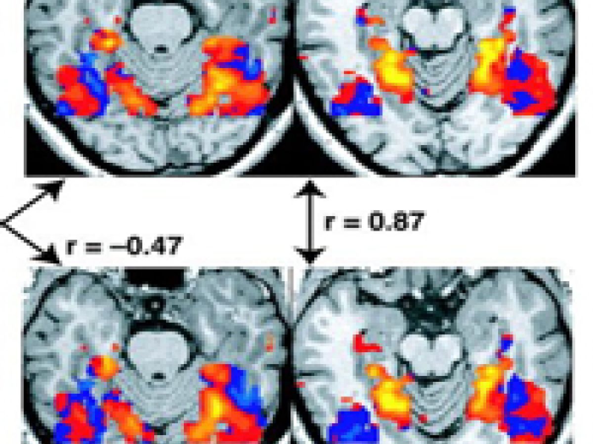fmri examples